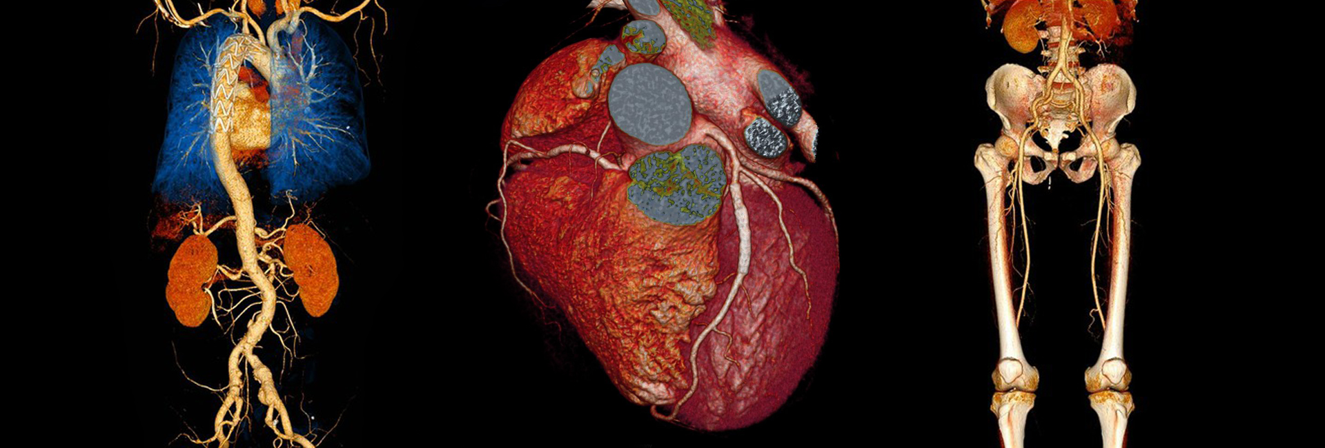 CT Computed Tomography Angiography Mittal Diagnostic Research